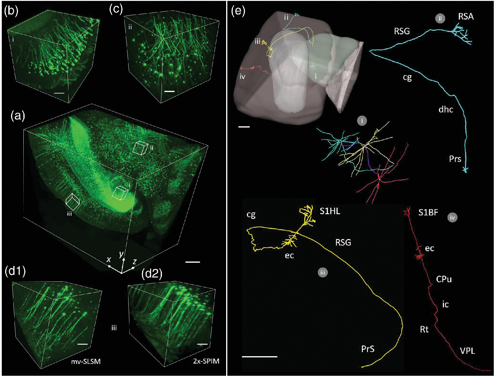 Subvoxel light-sheet microscopy for high-resolution high-throughput ... Subvoxel light-sheet microscopy for high-resolution high-throughput ...
