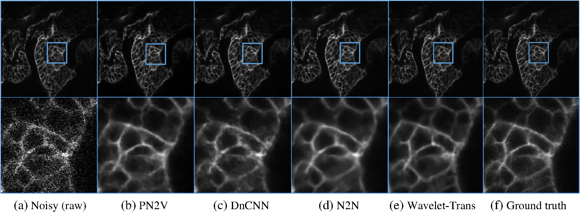 Fluorescence microscopy image denoising via a wavelet-enhanced ...