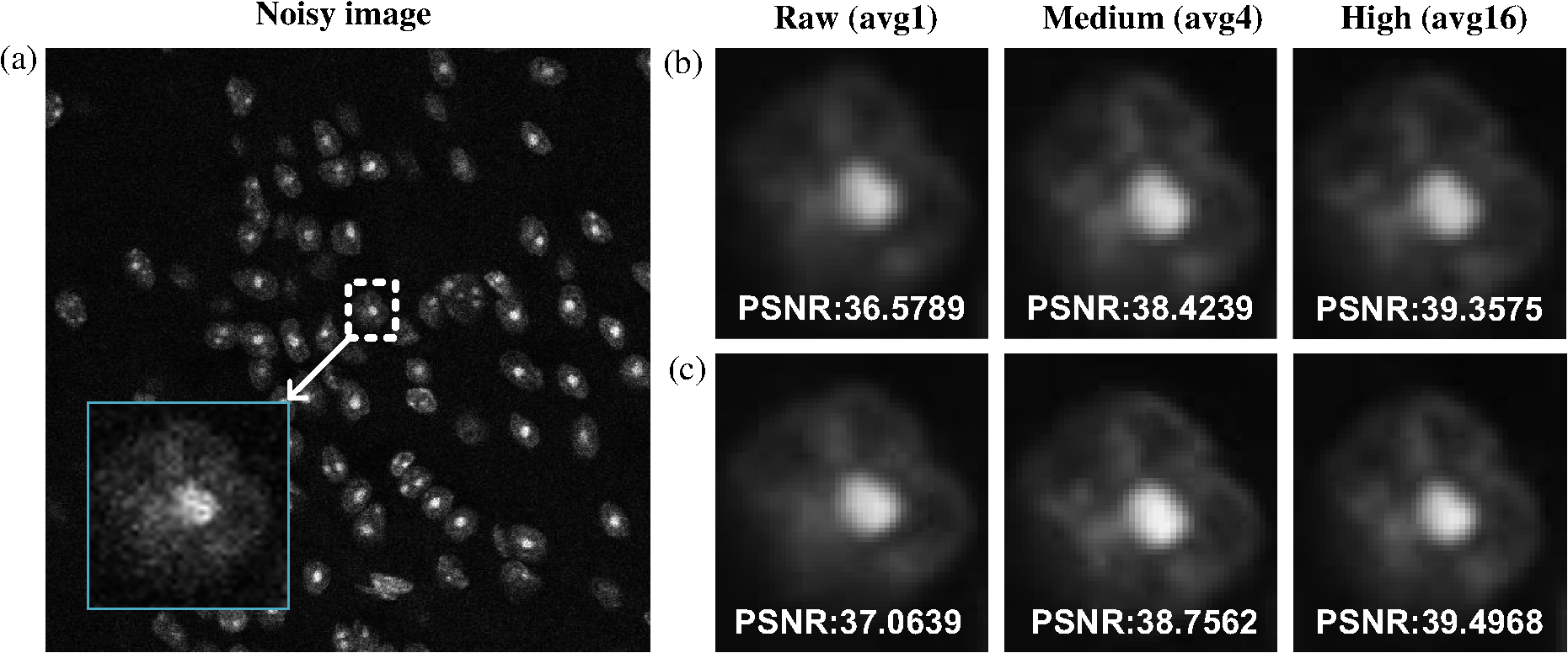 Fluorescence microscopy image denoising via a wavelet-enhanced ...
