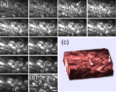 Three-dimensional nonlinear optical endoscopy