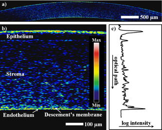 Dynamic analysis of chemical eye burns using high-resolution optical ...