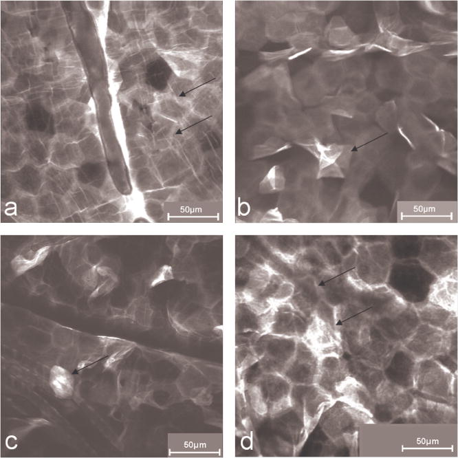 Clinical applicability of in vivo fluorescence confocal microscopy for ...