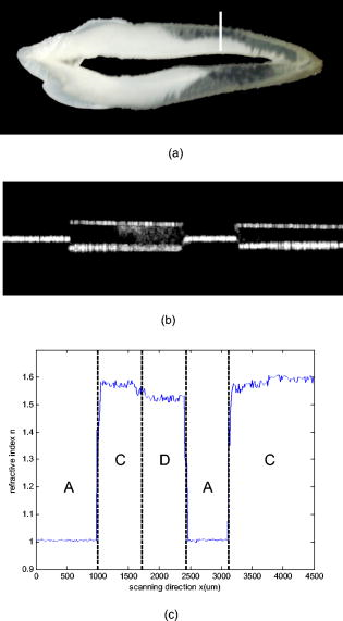Measurement of the refractive index of human teeth by optical coherence ...