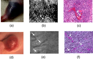 Dye-enhanced multimodal confocal microscopy for noninvasive detection ...