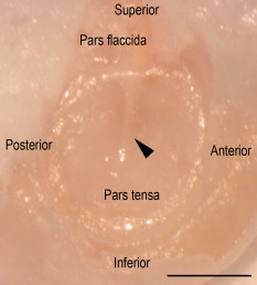 Virtual biopsy of rat tympanic membrane using higher harmonic ...