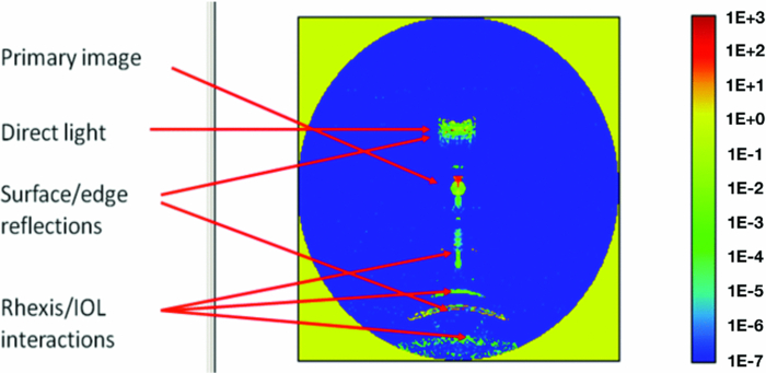 Ray-tracing optical modeling of negative dysphotopsia
