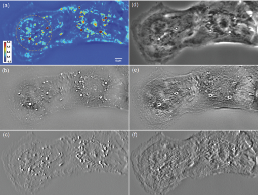 Label-free intracellular transport measured by spatial light ...