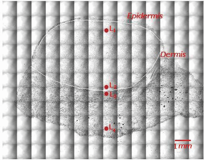 Multiphoton microscopy study of the morphological and quantity changes ...