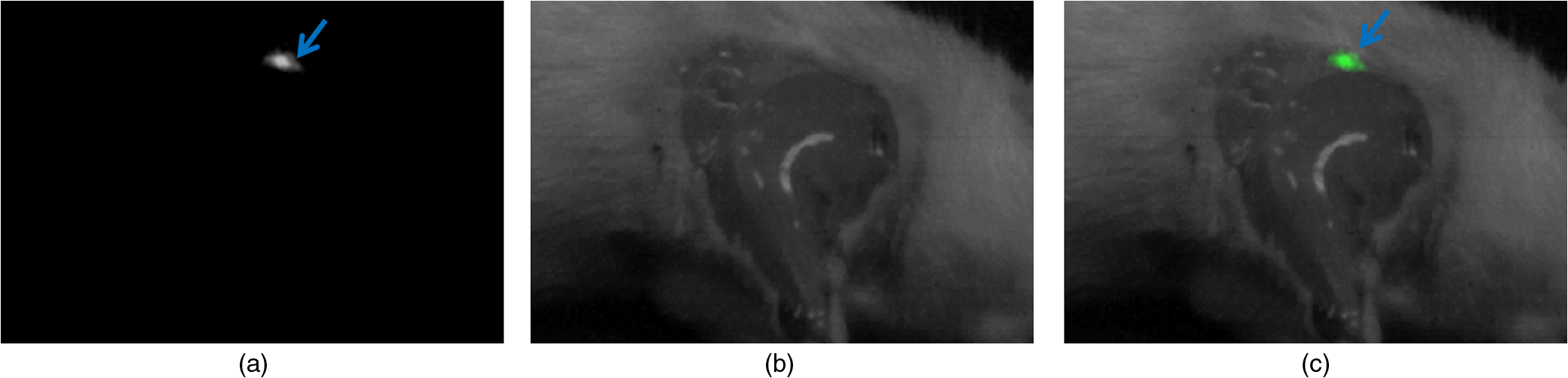 Near-infrared fluorescence goggle system with complementary metal–oxide ...