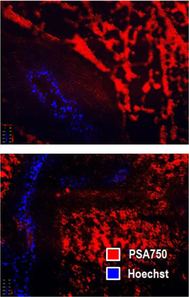 Detection and quantification of enzymatically active prostate-specific ...