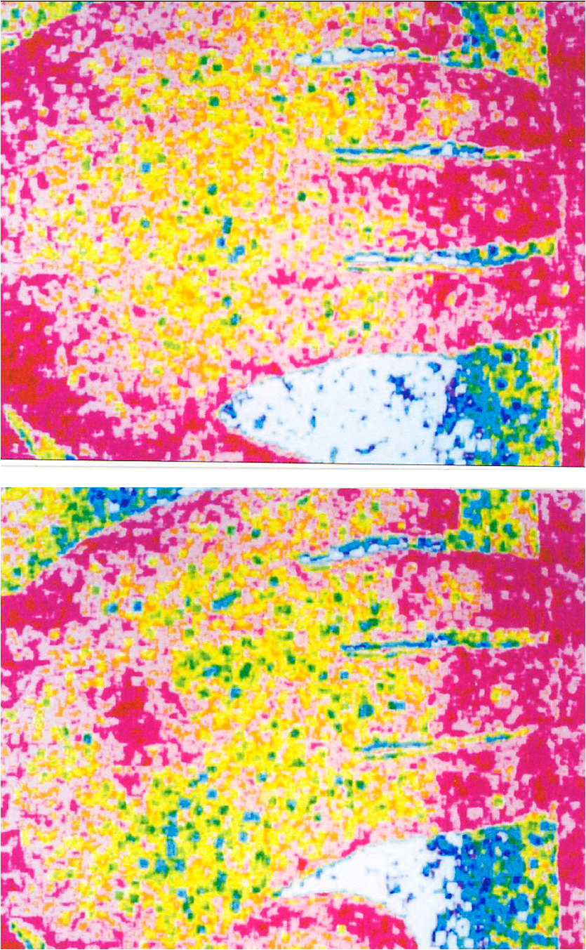 Laser speckle contrast imaging: theoretical and practical limitations