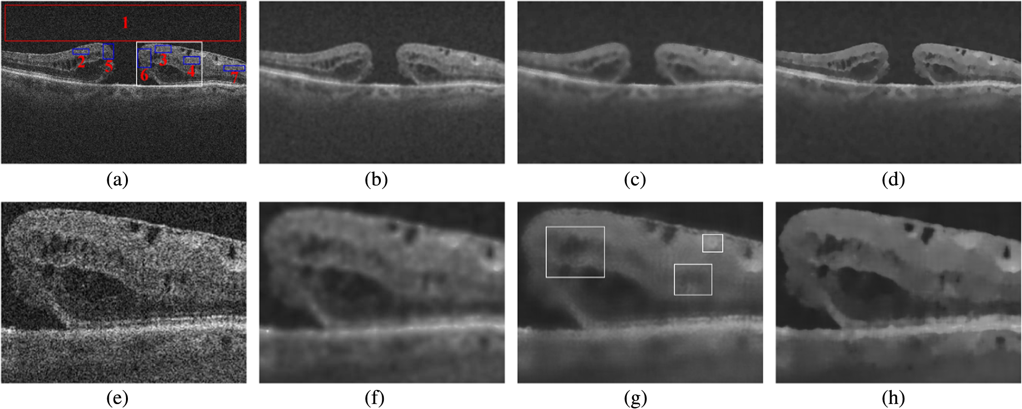 Spiking cortical model–based nonlocal means method for speckle ...