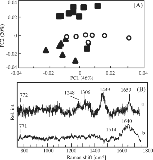 Noninvasive and label-free determination of virus infected cells by ...