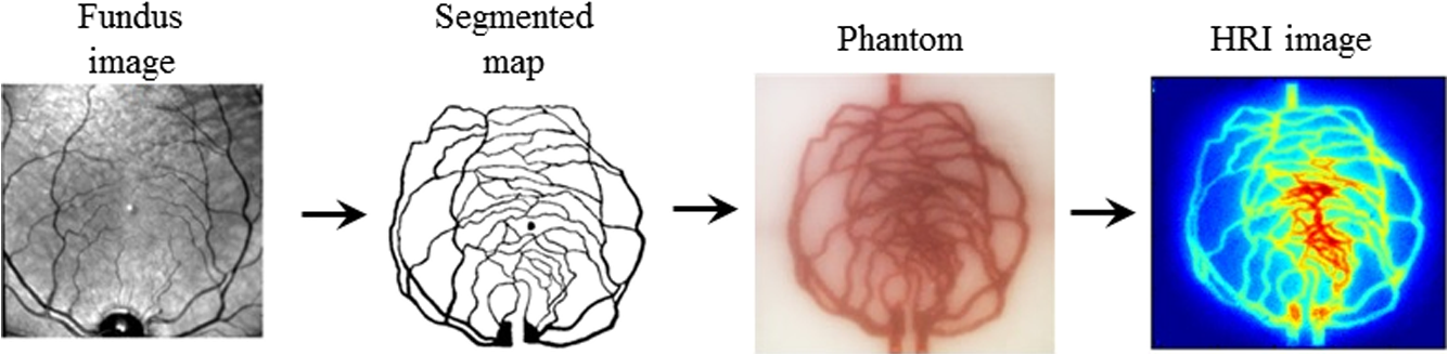 Rapid prototyping of biomimetic vascular phantoms for hyperspectral ...