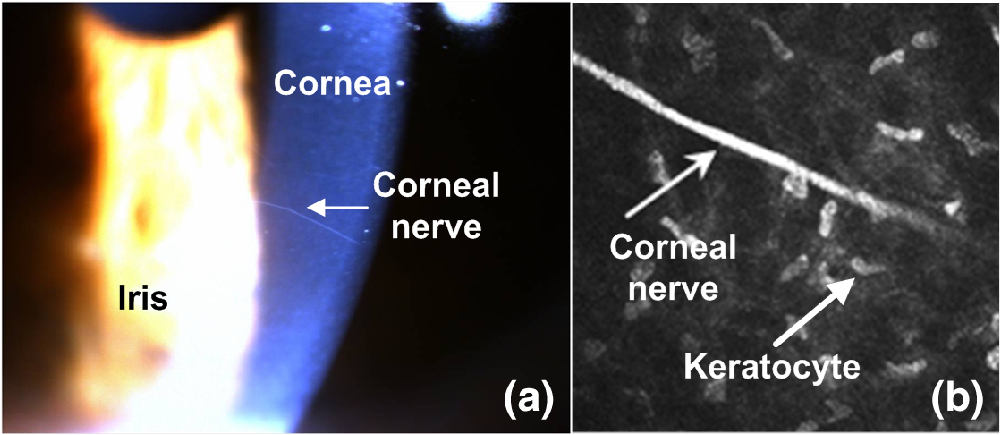 In Vivo Three Dimensional Imaging Of Human Corneal Nerves Using Fourier
