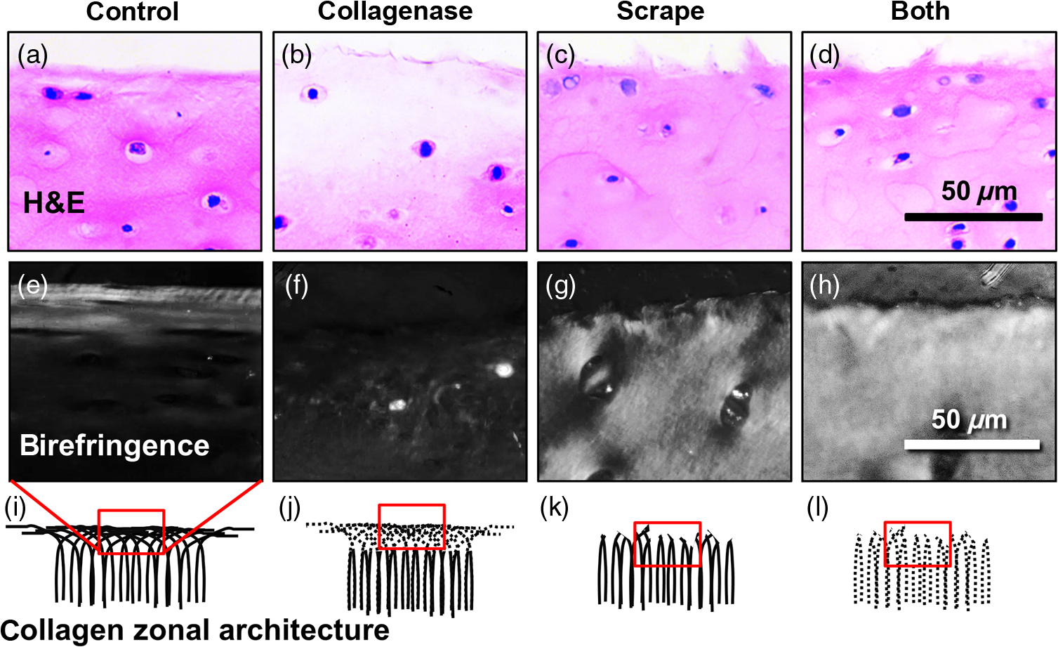 Noninvasive assessment of articular cartilage surface damage using ...