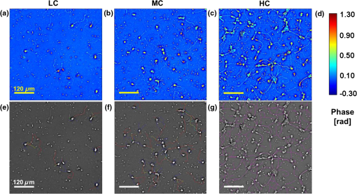Quantitative assessment of neural outgrowth using spatial light ...
