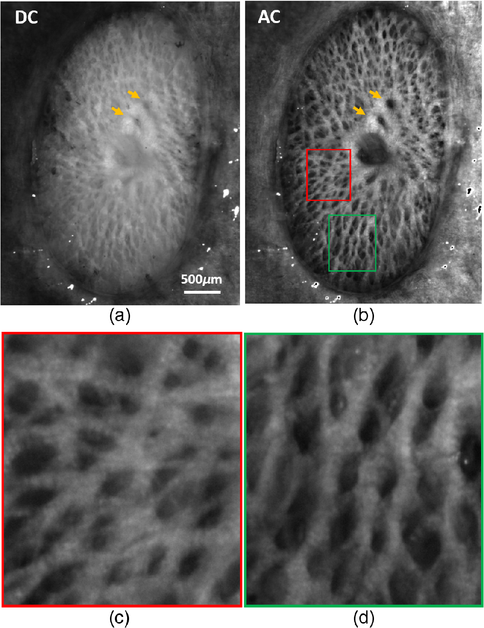 Structured polarized light microscopy for collagen fiber structure and ... Structured polarized light microscopy for collagen fiber structure and ...
