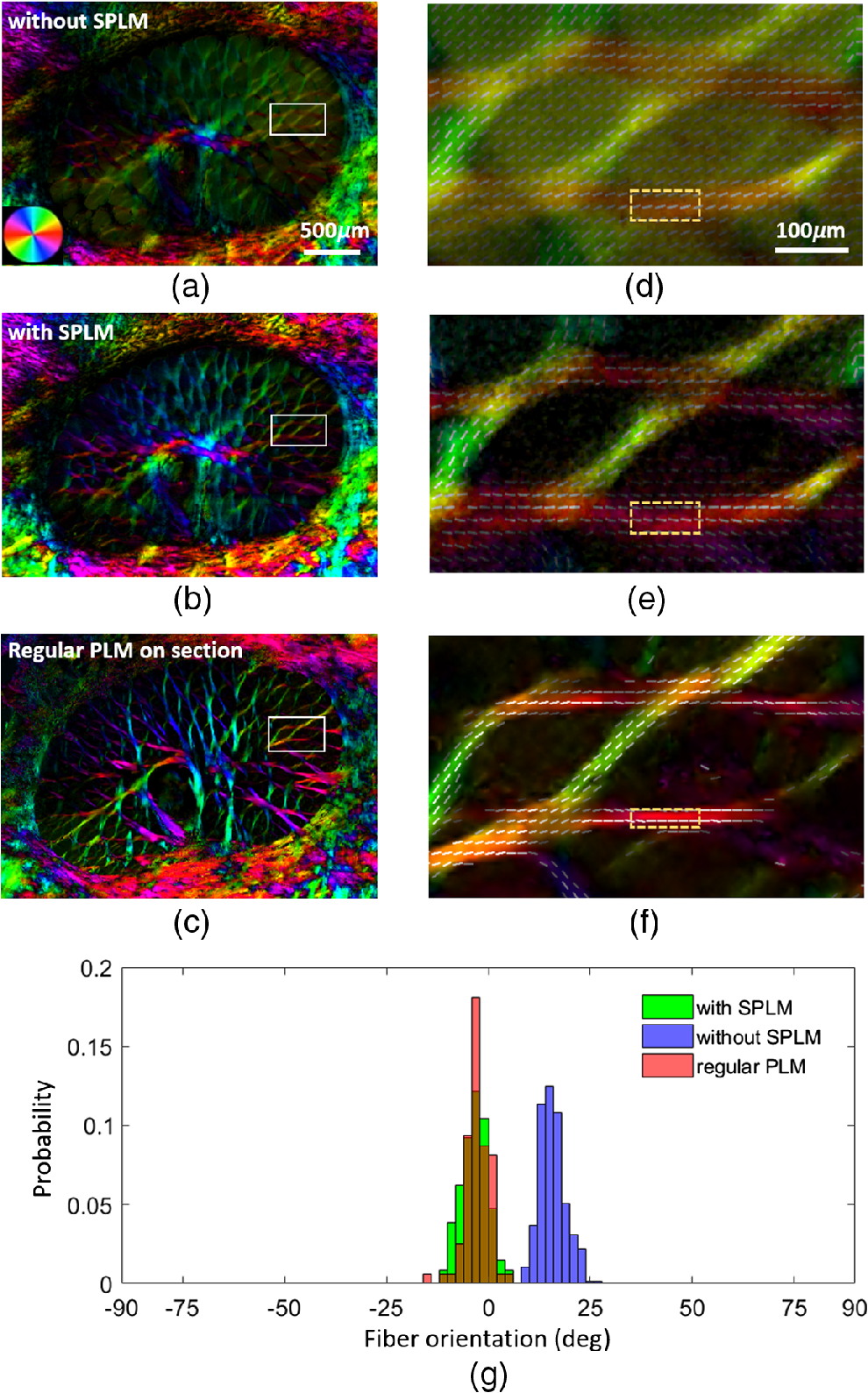 Structured polarized light microscopy for collagen fiber structure and ... Structured polarized light microscopy for collagen fiber structure and ...