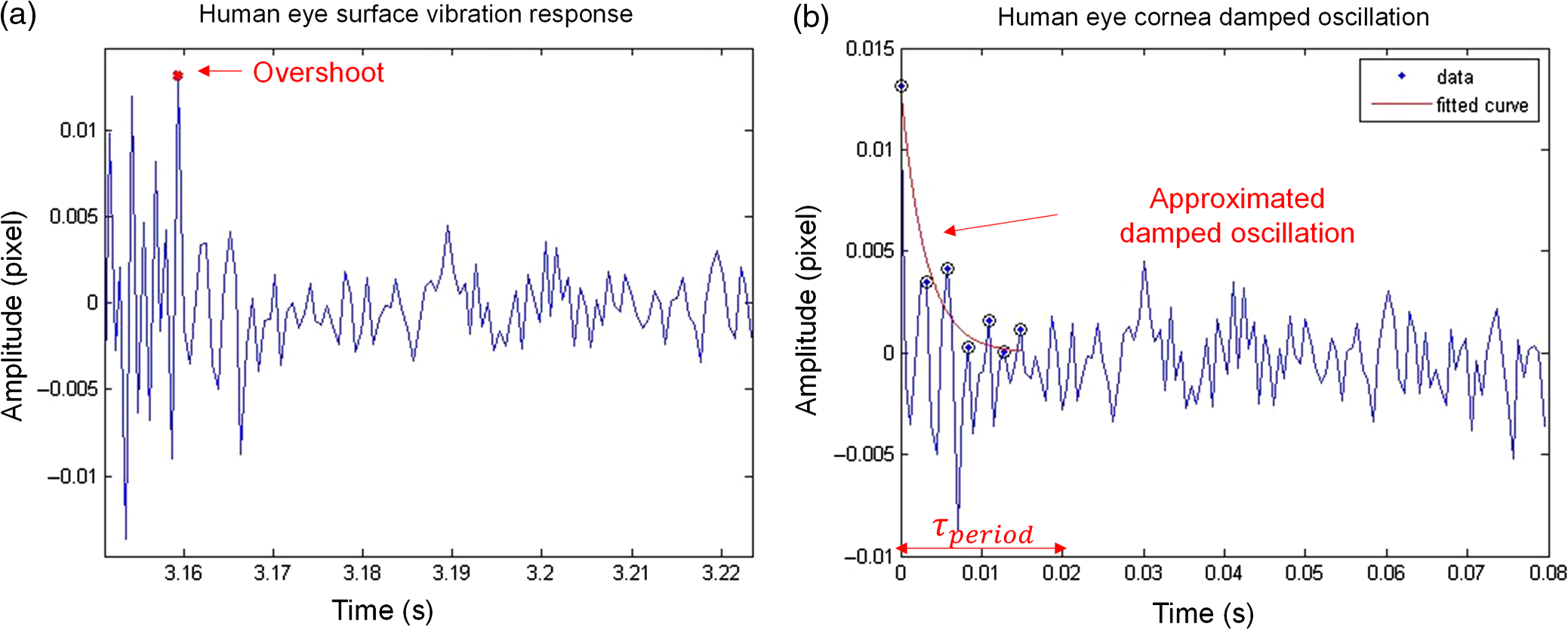 Intraocular pressure remote photonic biomonitoring based on temporally ...