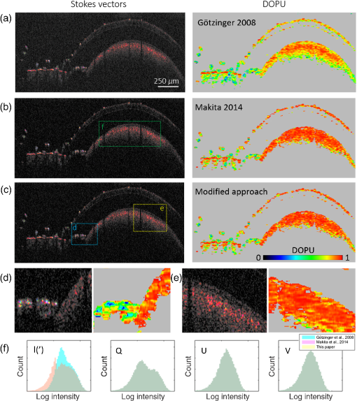 Polarization-sensitive optical coherence tomography imaging of the ...