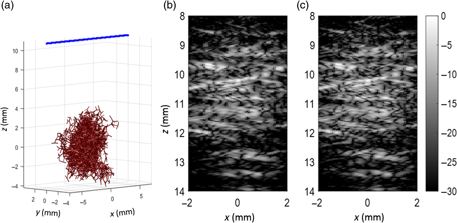 Photoacoustic simulations of microvascular bleeding: spectral analysis ...