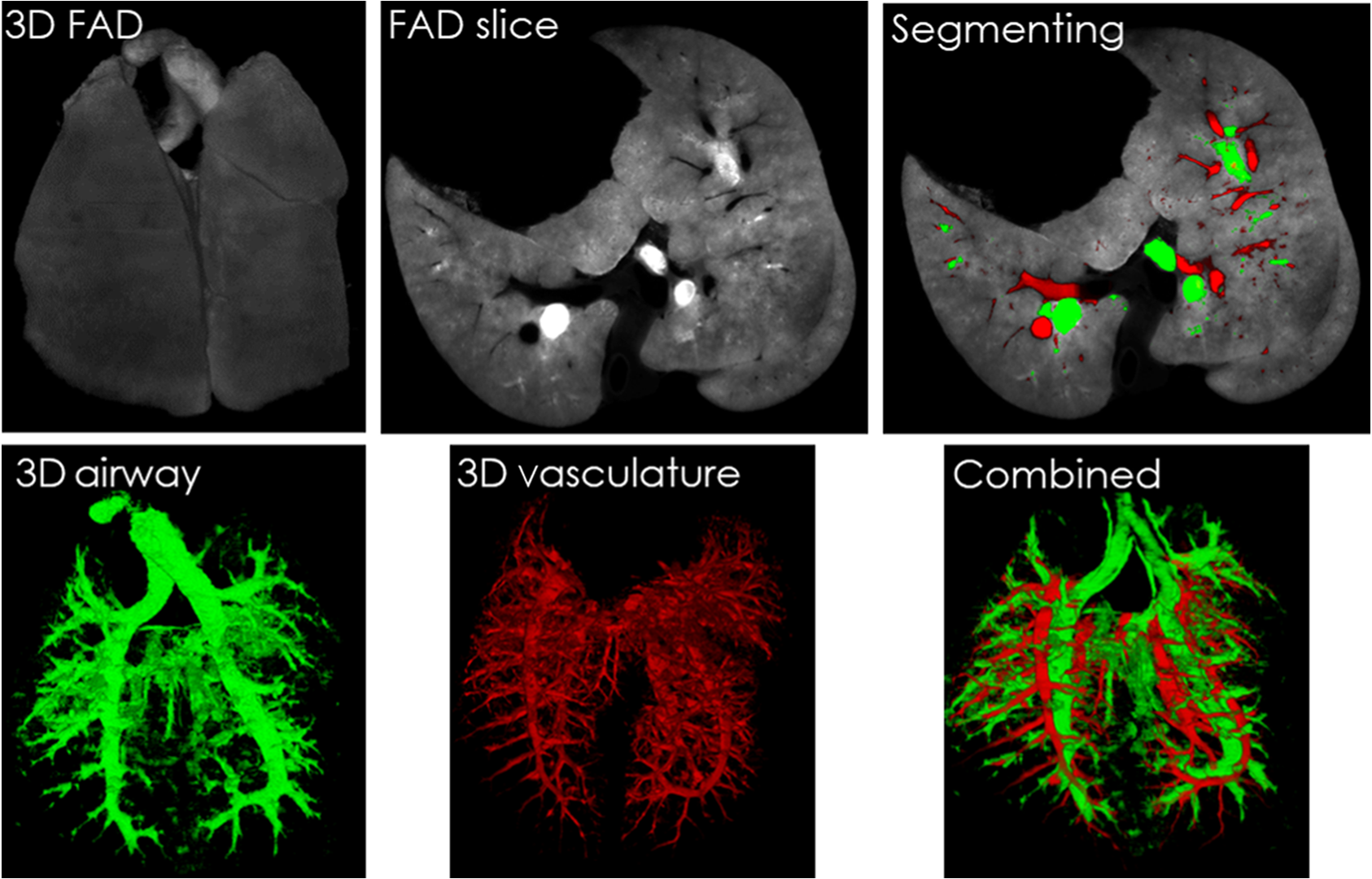 Three Dimensional Vascular And Metabolic Imaging Using Inverted