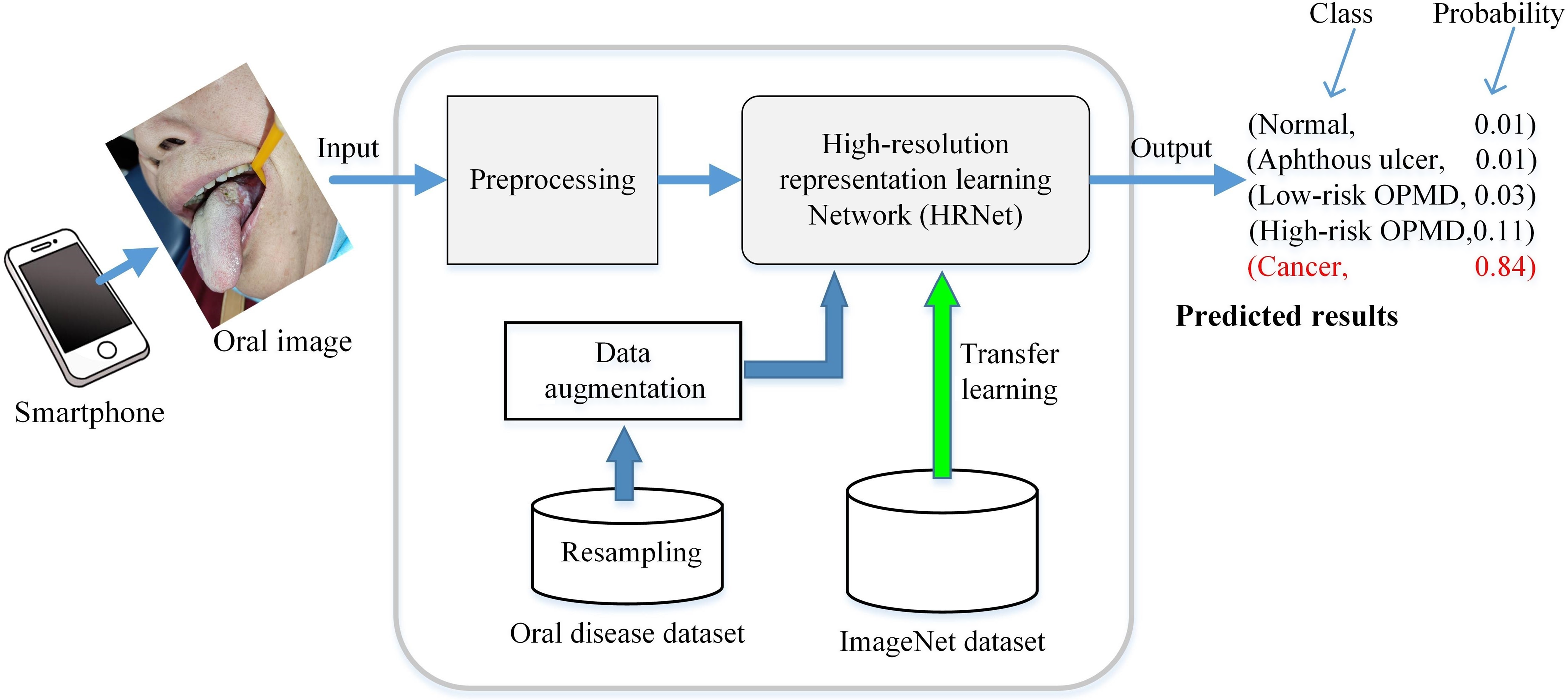 Automatic detection of oral cancer in smartphone-based images using ...