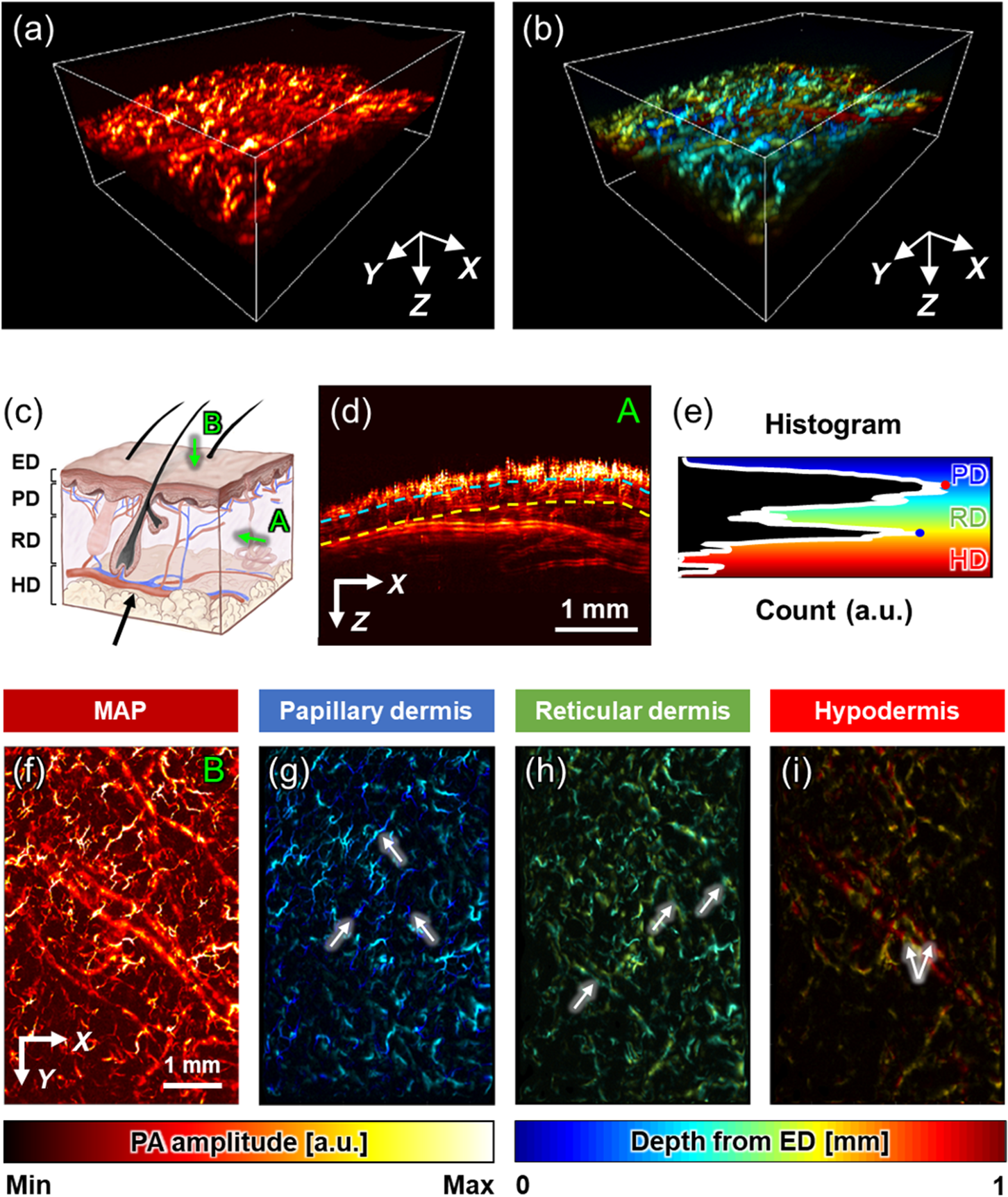 In vivo quantitative photoacoustic monitoring of corticosteroid-induced ...