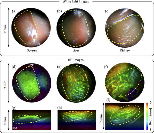 Dual-modality rigid endoscope for photoacoustic imaging and white light ...