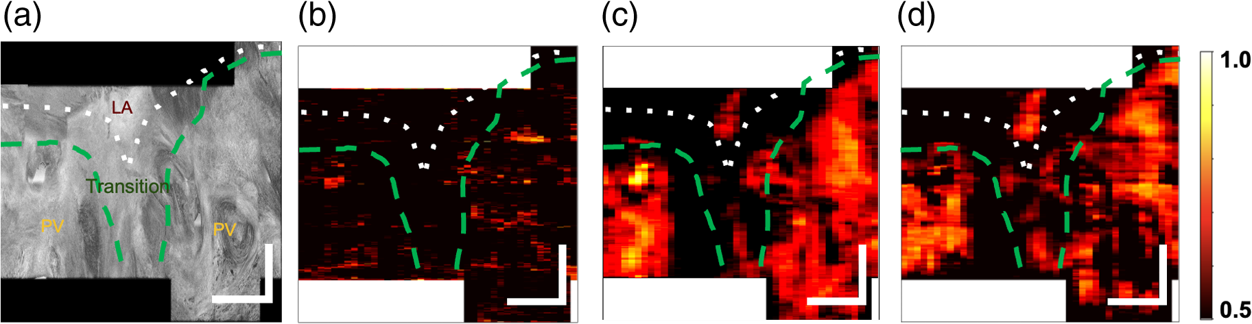 Optical coherence tomography–enabled classification of the human ...