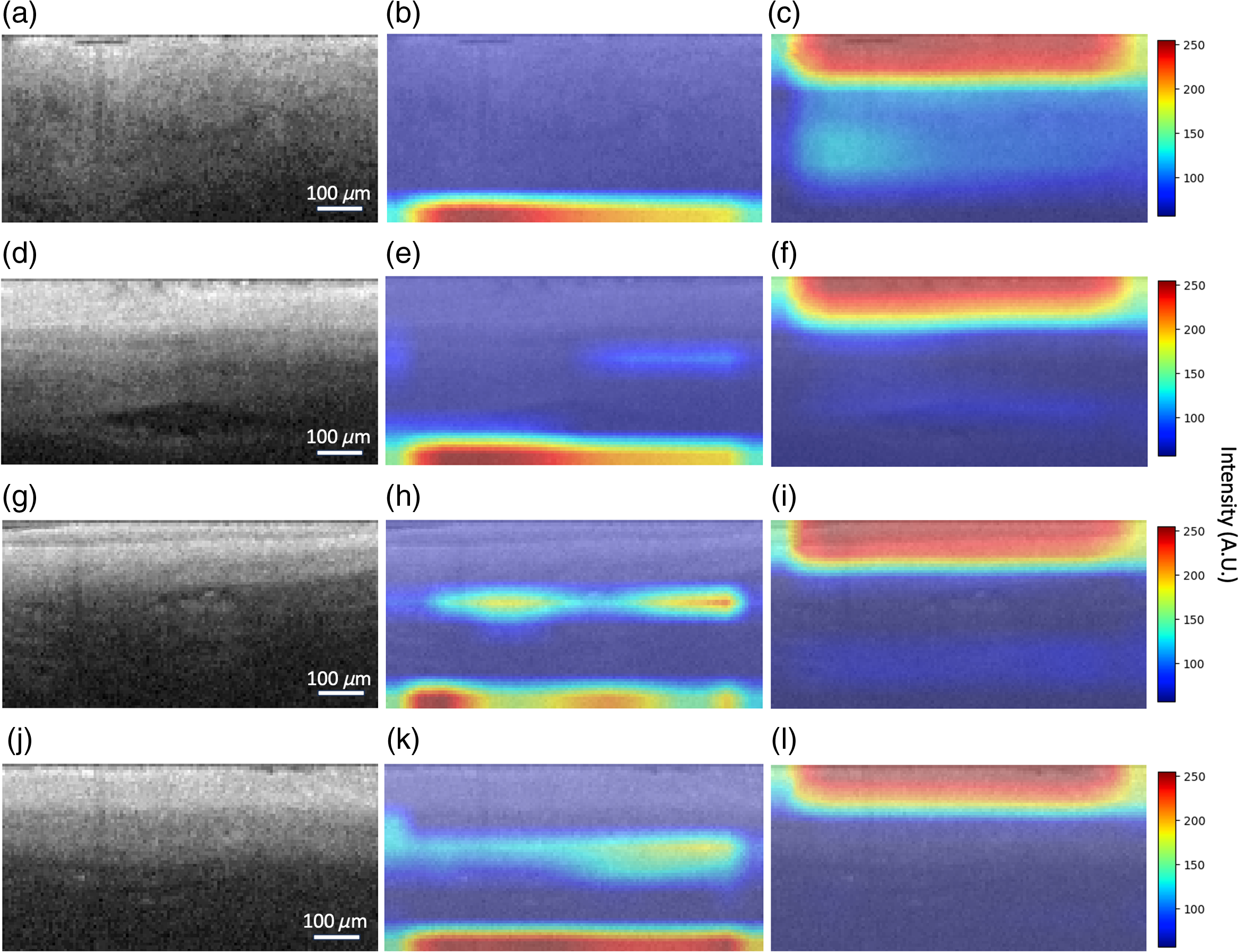 Optical coherence tomography–enabled classification of the human ...