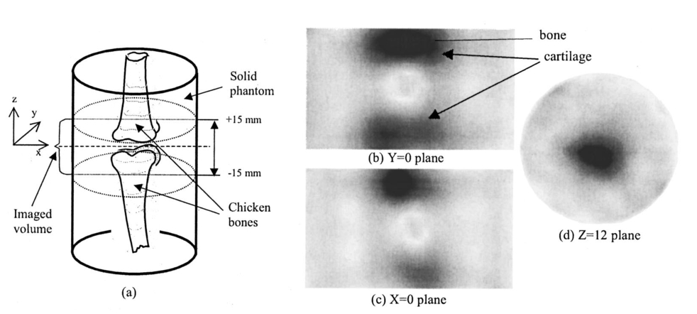 Three Dimensional Diffuse Optical Tomography Of Bones And Joints