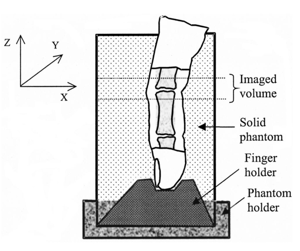 Three Dimensional Diffuse Optical Tomography Of Bones And Joints