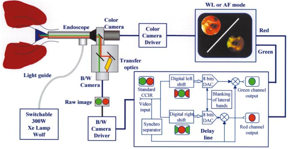 In vivo autofluorescence imaging of early cancers in the human ...