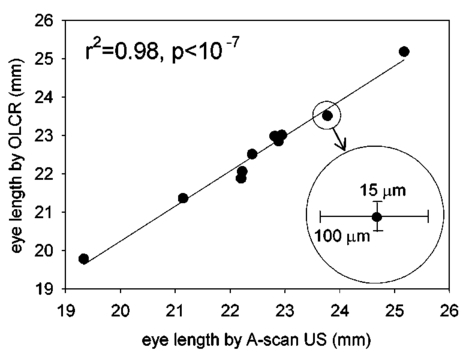 Axial and peripheral eye length measured with optical low coherence ...