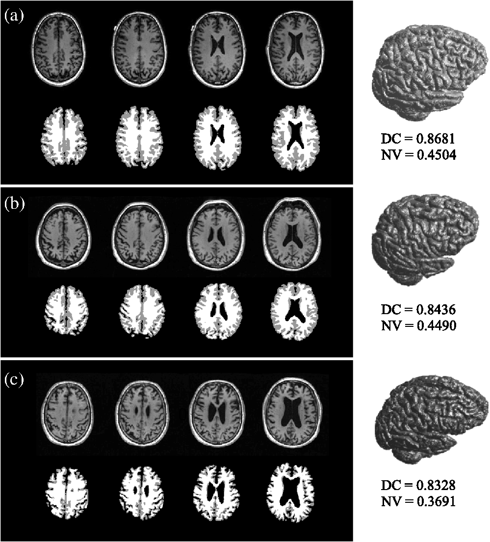 Description and classification of normal and pathological aging ...