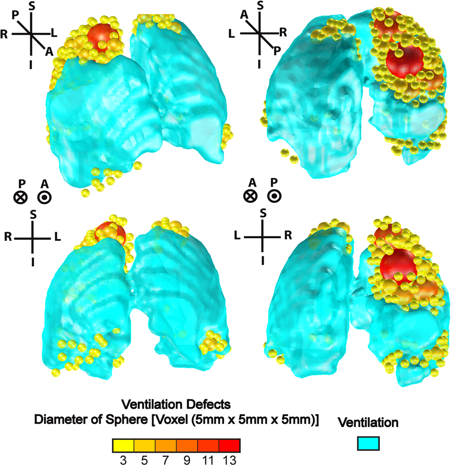 Machine learning and magnetic resonance image texture analysis predicts ...