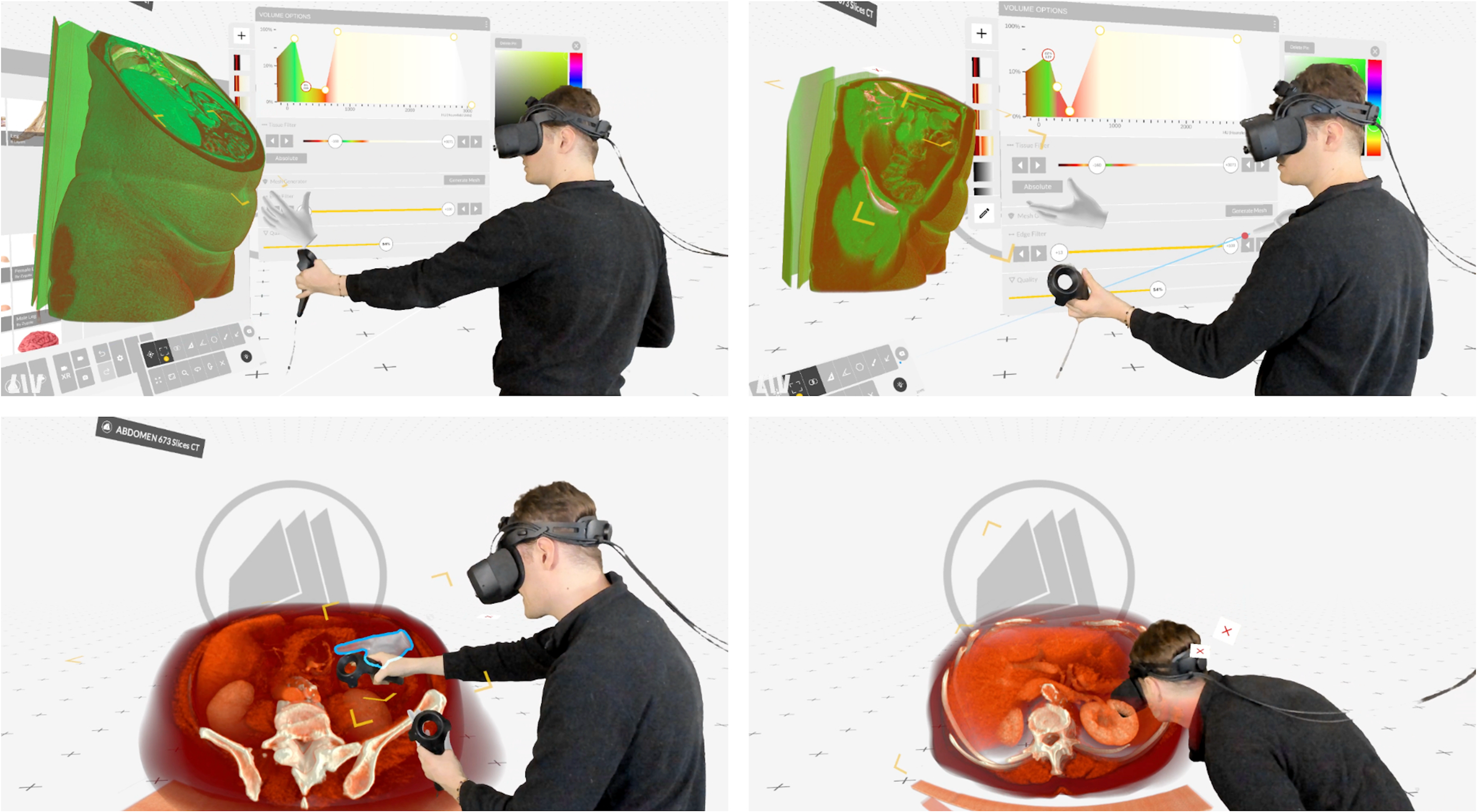 Surgical planning in virtual reality: a systematic review