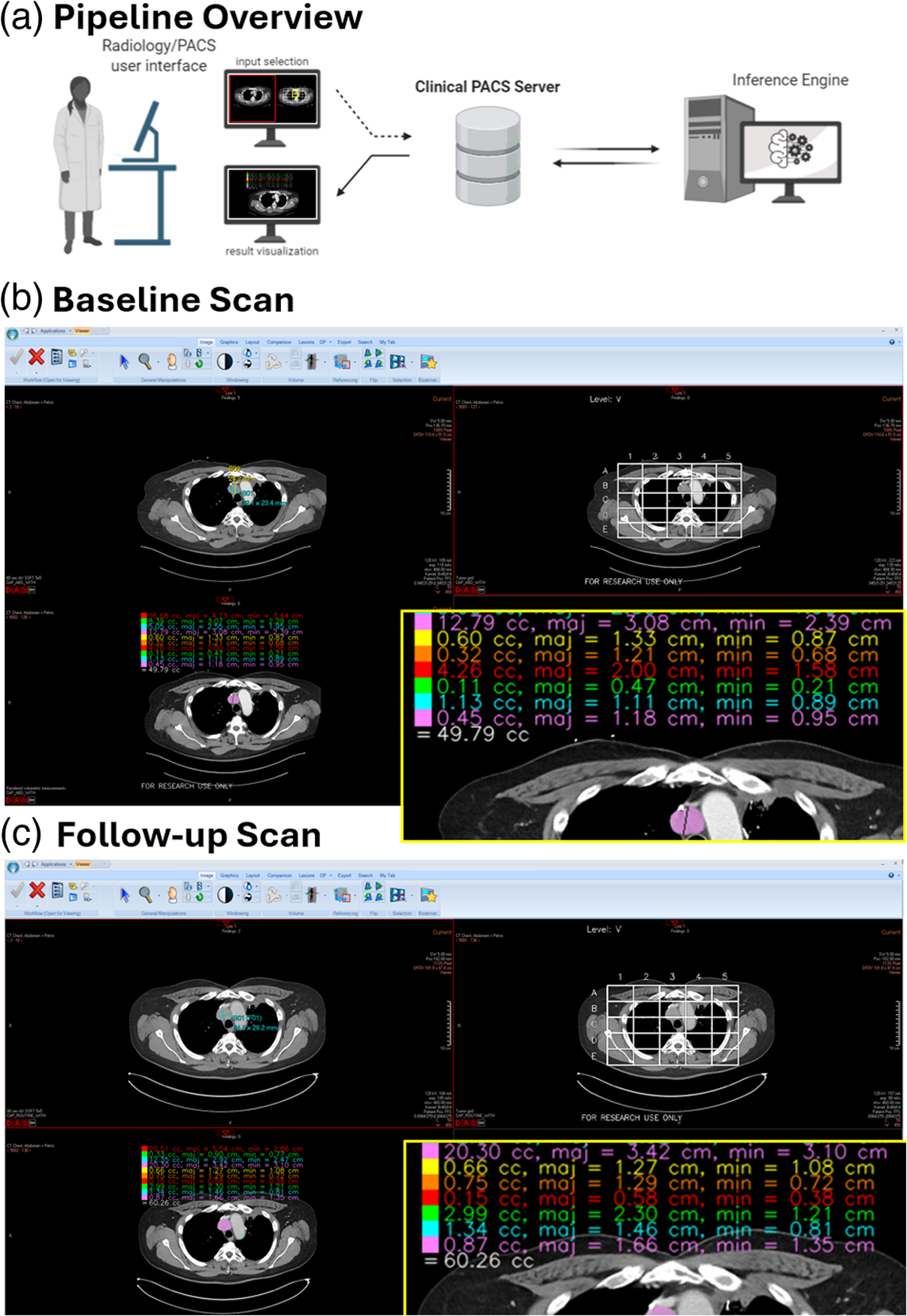 Physician-guided deep learning model for assessing thymic epithelial ...