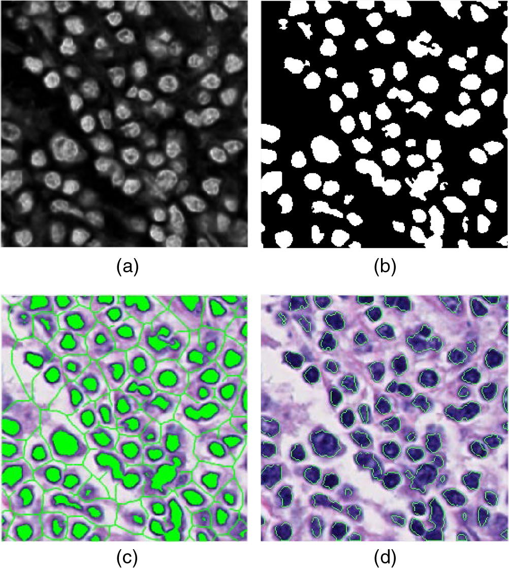 Automatic extraction of cell nuclei from H&E-stained histopathological ... Automatic extraction of cell nuclei from H&E-stained histopathological ...