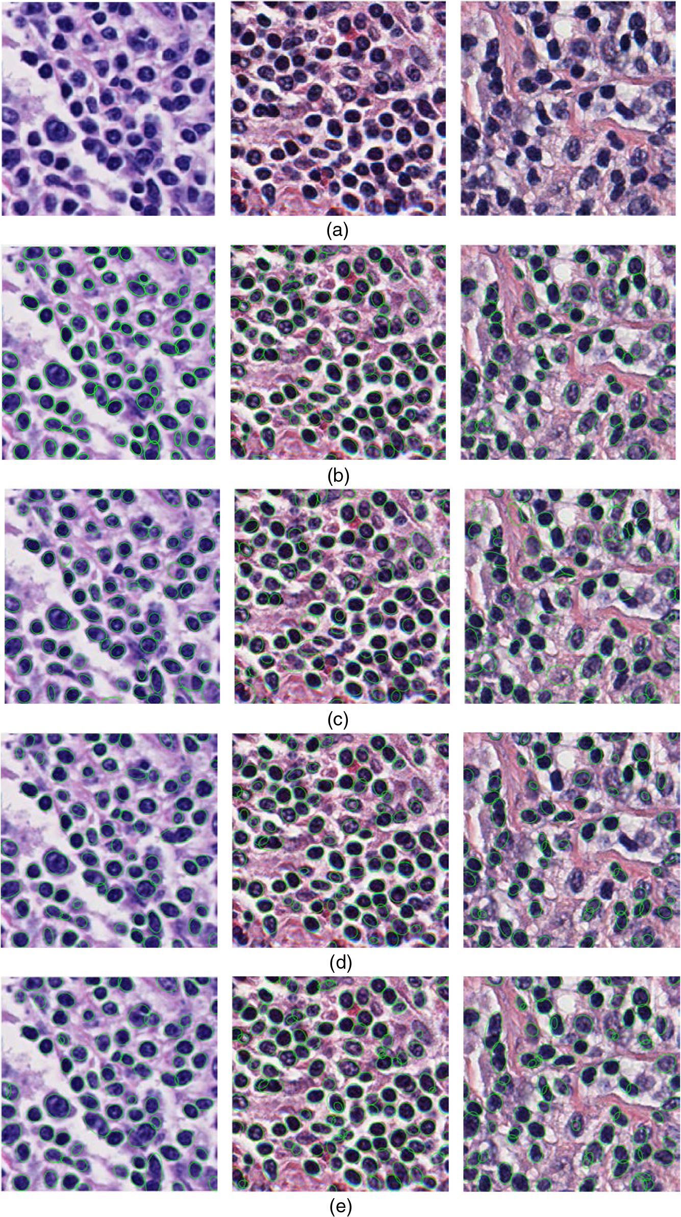 Automatic extraction of cell nuclei from H&E-stained histopathological ... Automatic extraction of cell nuclei from H&E-stained histopathological ...
