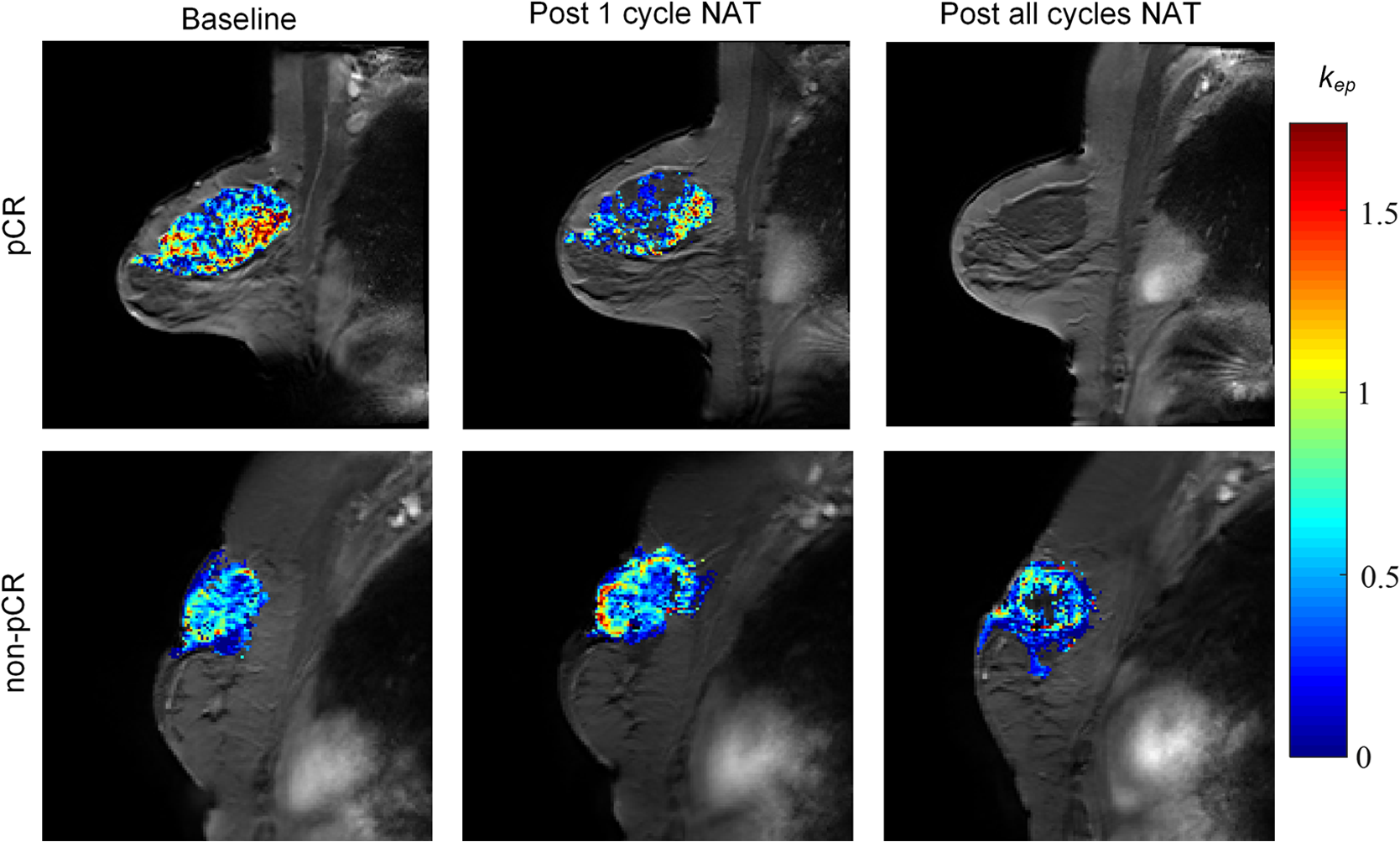 Dynamic Contrast Enhanced Magnetic Resonance Imaging And Diffusion