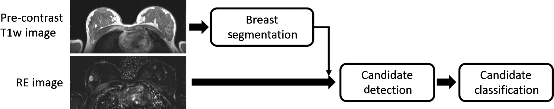 Fully automated detection of breast cancer in screening MRI using ...