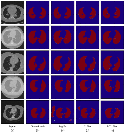Recurrent residual U-Net for medical image segmentation Recurrent residual U-Net for medical image segmentation