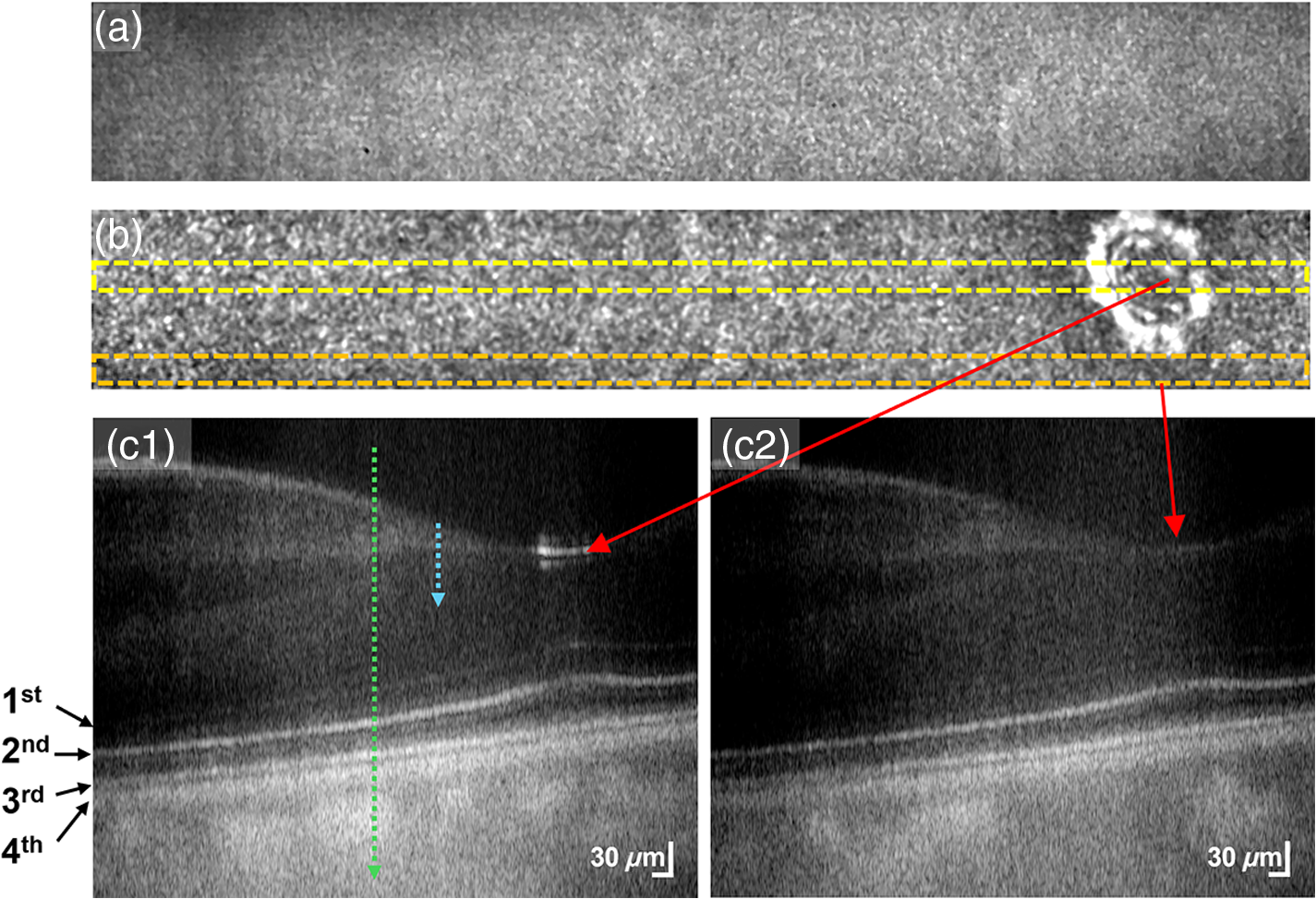 Polarization optical coherence tomography optoretinography: verifying ...
