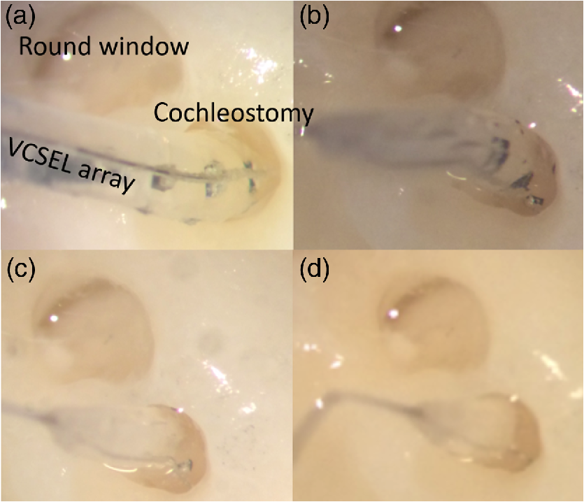 Multichannel optrodes for photonic stimulation