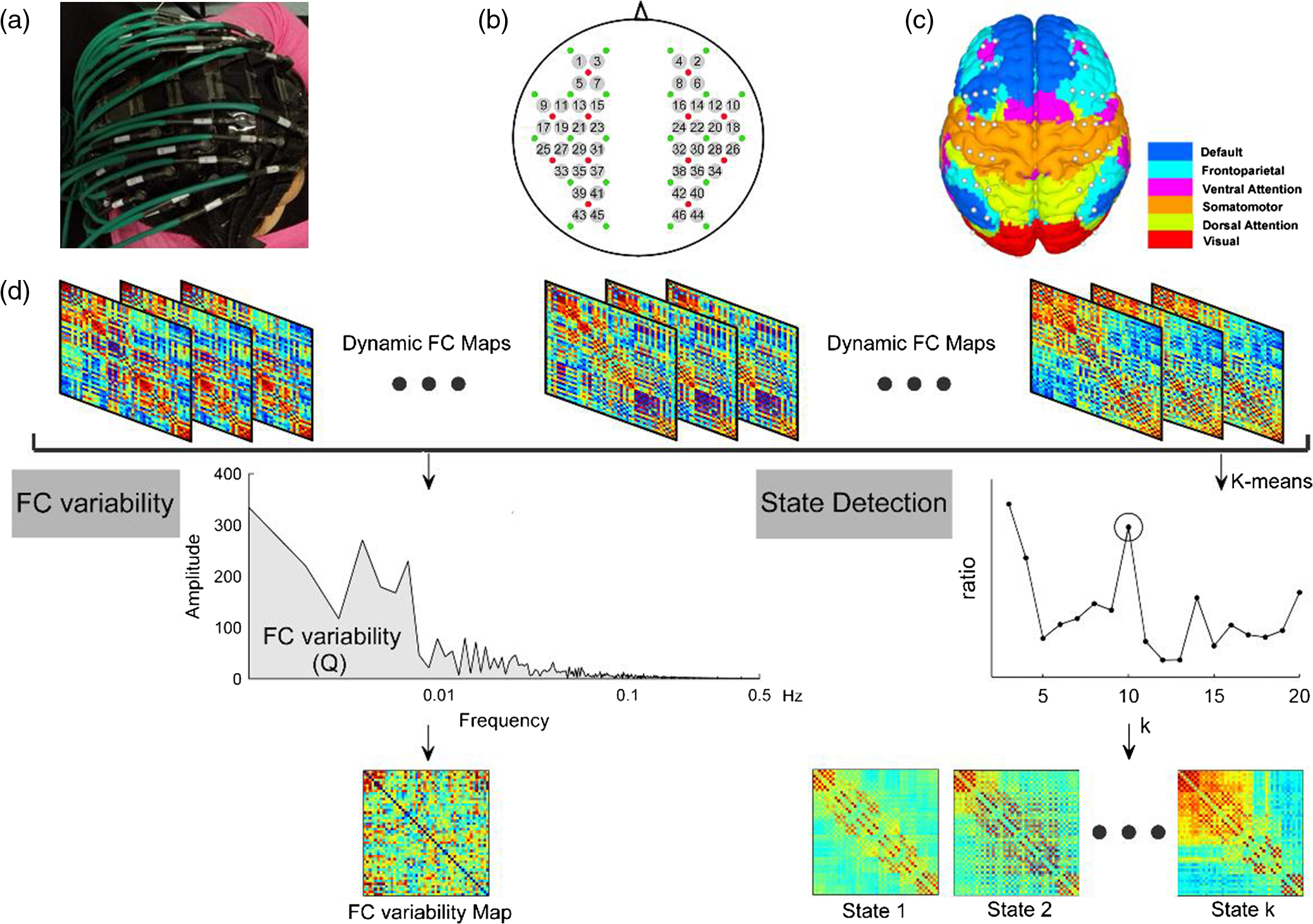 Abnormal Dynamic Functional Connectivity And Brain States In Alzheimer