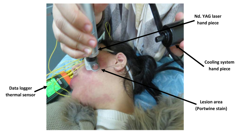 Medical laser safety